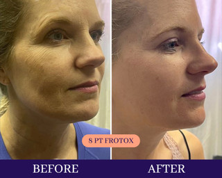 Cryo Care Gallery – Cyro Care